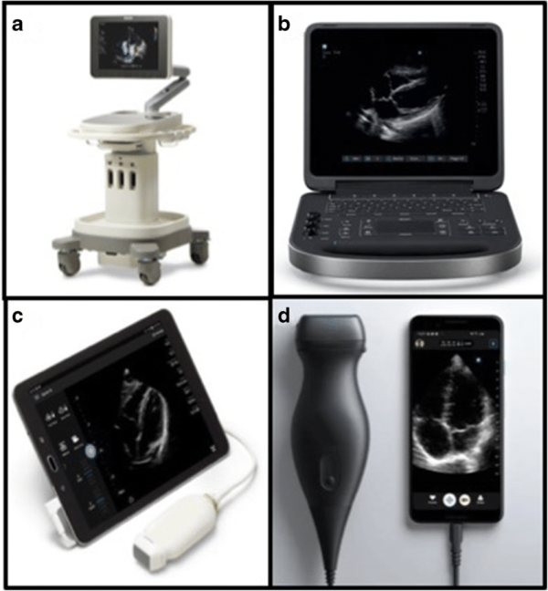POCUS چیست؟ - متد